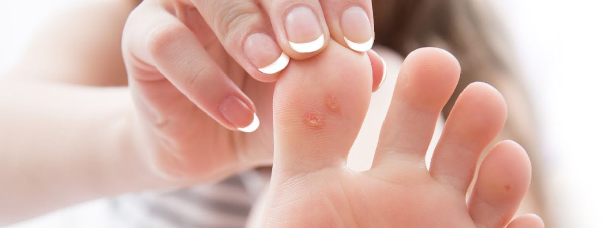 Topeka Bunion Surgery & Treatment - Gateley Podiatry